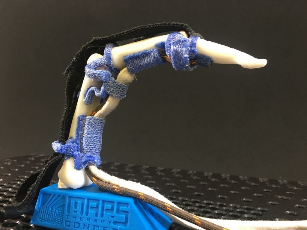 MAPS ANATOMY KIT A001 - FINGER - MAPS Therapy